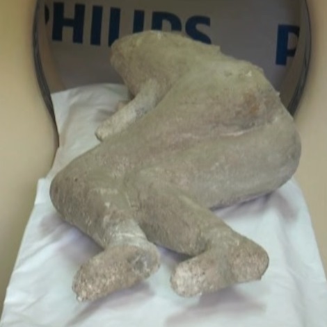 Pompei, tac su calchi vittime eruzione: alimentazione sana e denti ...